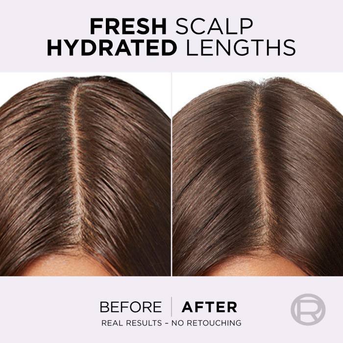 Elvive Hyaluron Pure Hair Care Hair Serum for Oily Scalp and Dry Ends ...